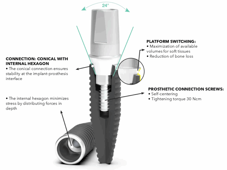 Dental Implants System | MESA Italia Professional Solutions